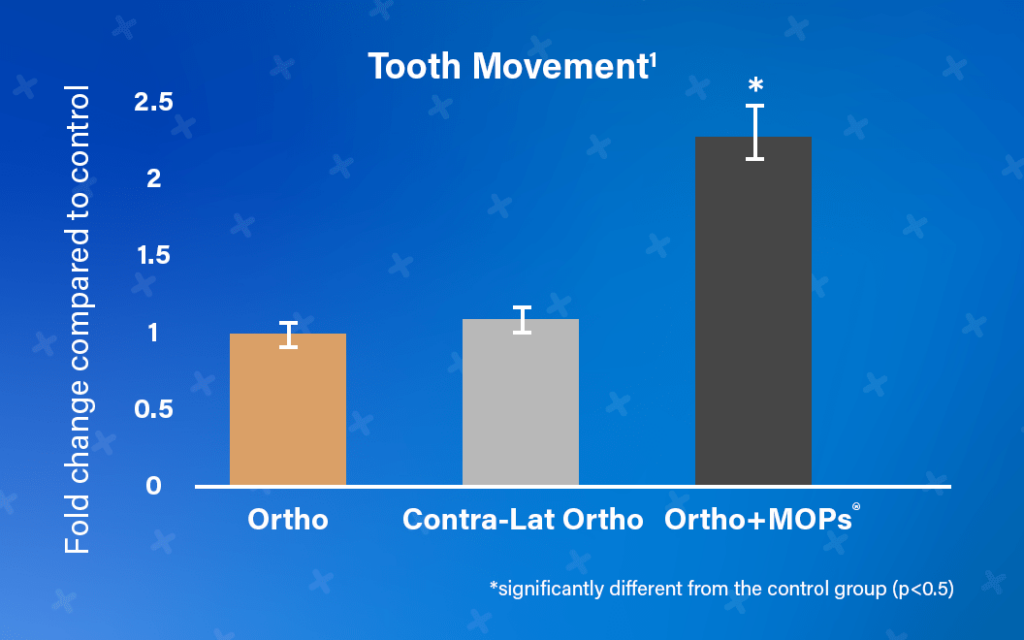 MOPs and Orthodontic Tooth Movement | Propel Orthodontics