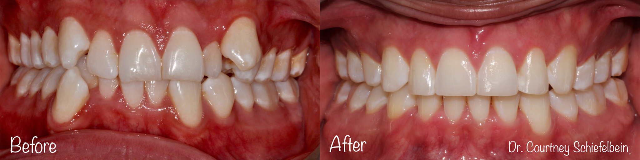 Doctor Spotlight: Courtney Schiefelbein | Propel Orthodontics